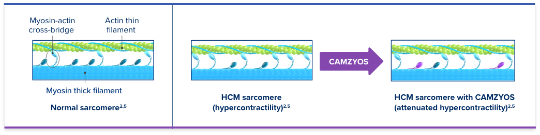 CAMZYOS® (mavacamten) Mechanism of Action | Safety Profile